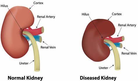 Lower Right Back Pain: Causes, & Treatment - Clarendon Chiropractic